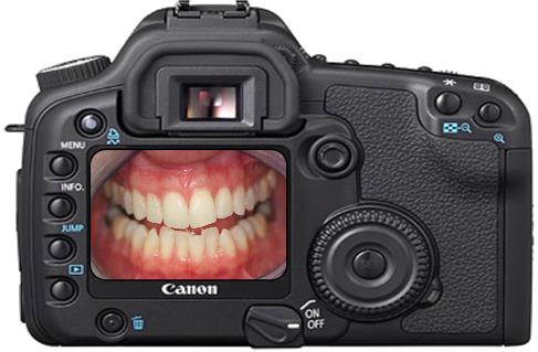 Digital Photography | Expertec Dental Lab-